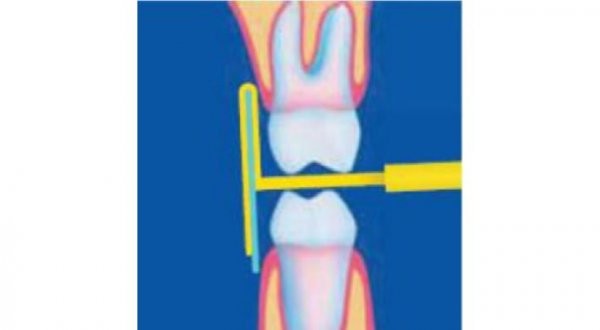 Posicionador BiteWing Kwik-Bite - Kerr | Dotamed São João