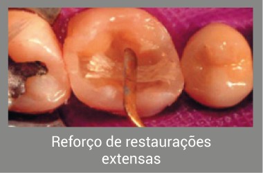 Interlig Fibra Vidro Trançada em Resina | Angelus