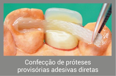 Interlig Fibra Vidro Trançada em Resina | Angelus