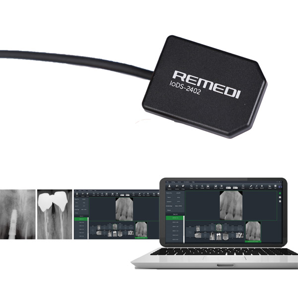 Sensor Intraoral RVG | Remedi – Dotamed São João